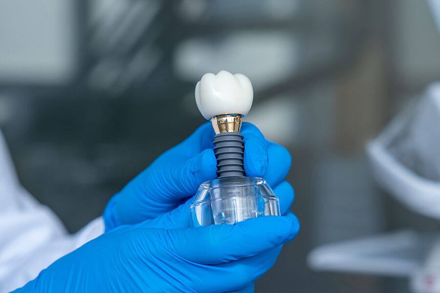 Implantul dentar în locul molarului de minte. Este necesar să refacem ...